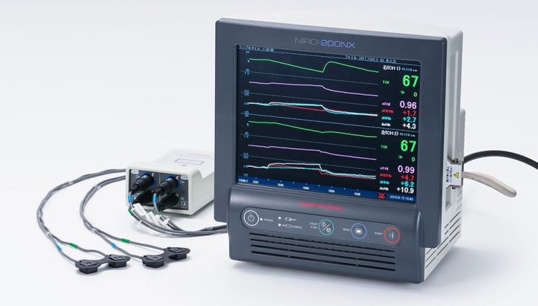 Functional Near Infrared Spectroscopy (fNIRS): List of manufactures ...